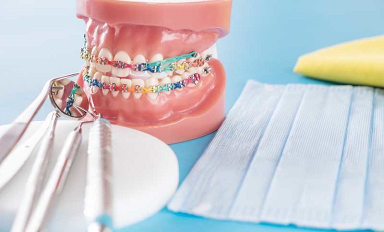 What to Do If Your Dental Braces Break | Absolute Dental